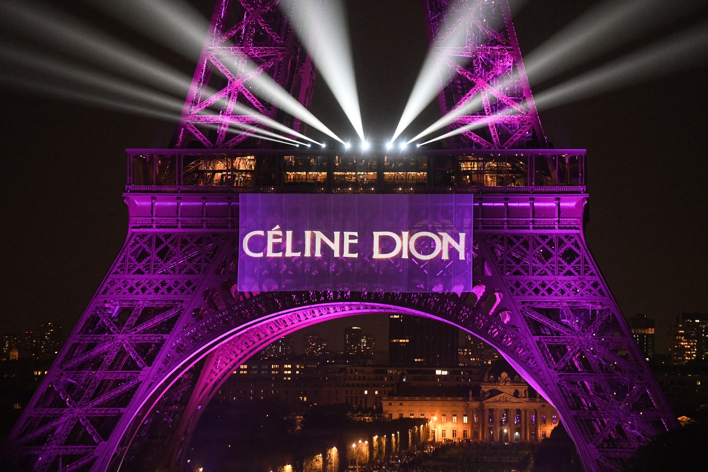 Lékaři hlásí průlom: Nemoc, která zničila kariéru Céline Dion, možná ...